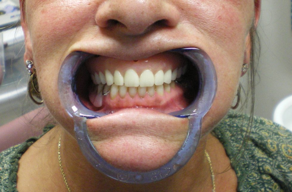Photo Gallery - The Denture Doctor